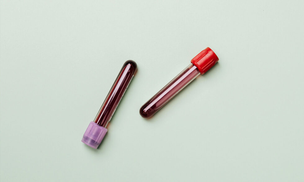 Course 28 Interpretation of Bloodwork in Ruminants - Large Animal ...