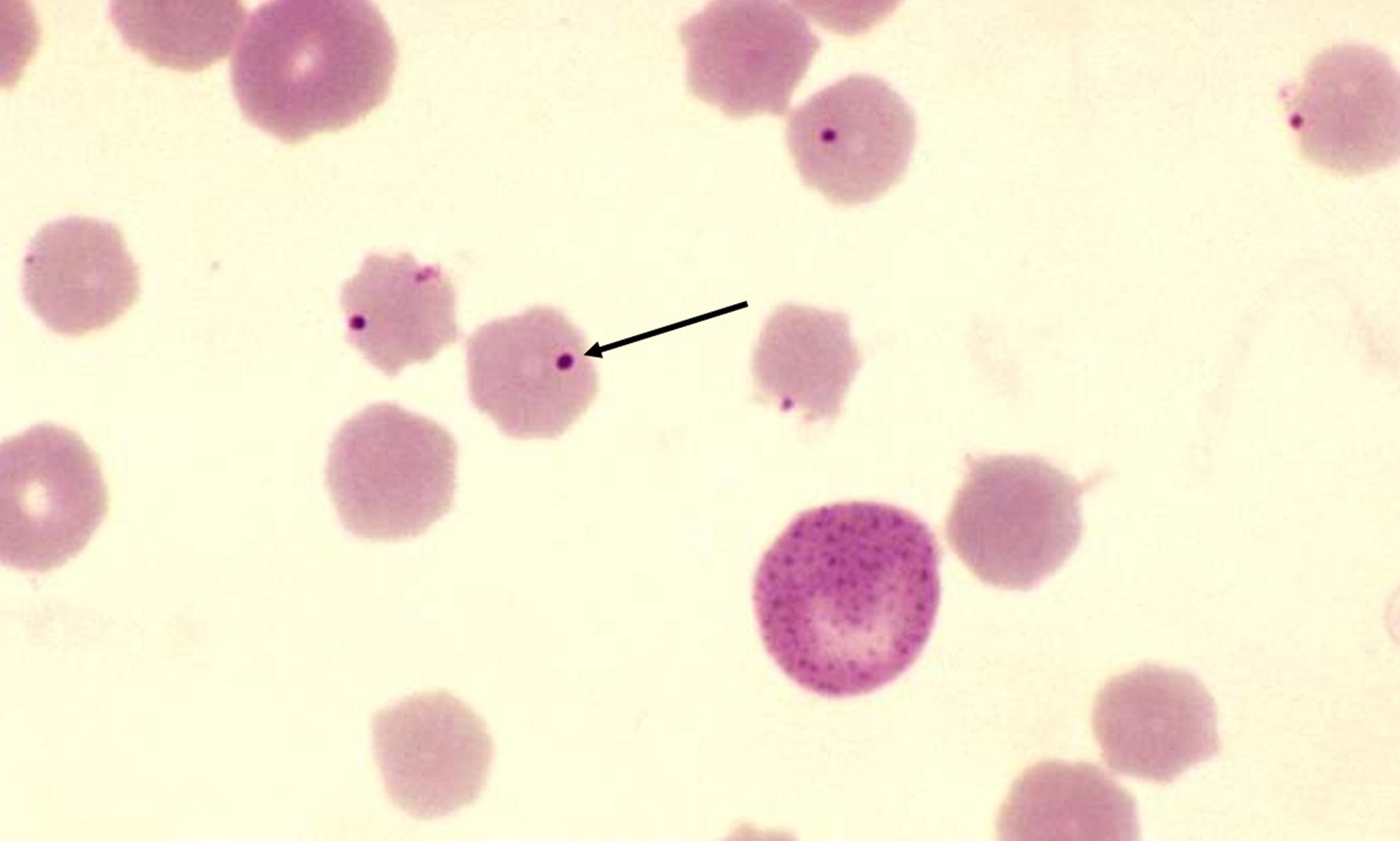 Five Things You Should Know About Anaplasmosis - Large Animal ...